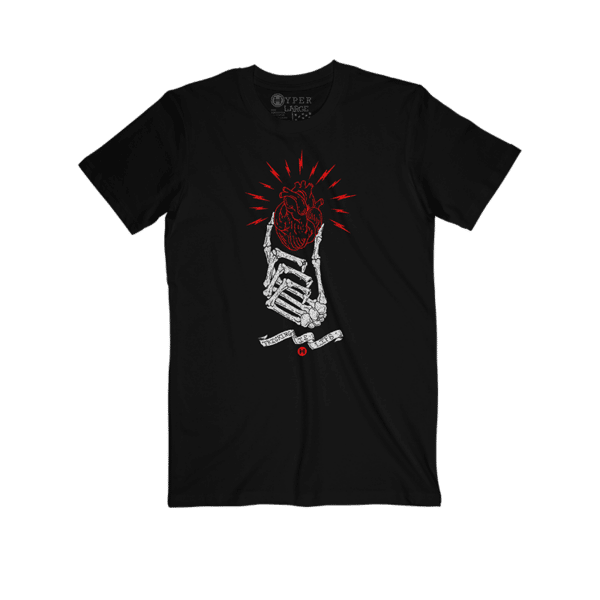 Surplus - WeAreHyper.com